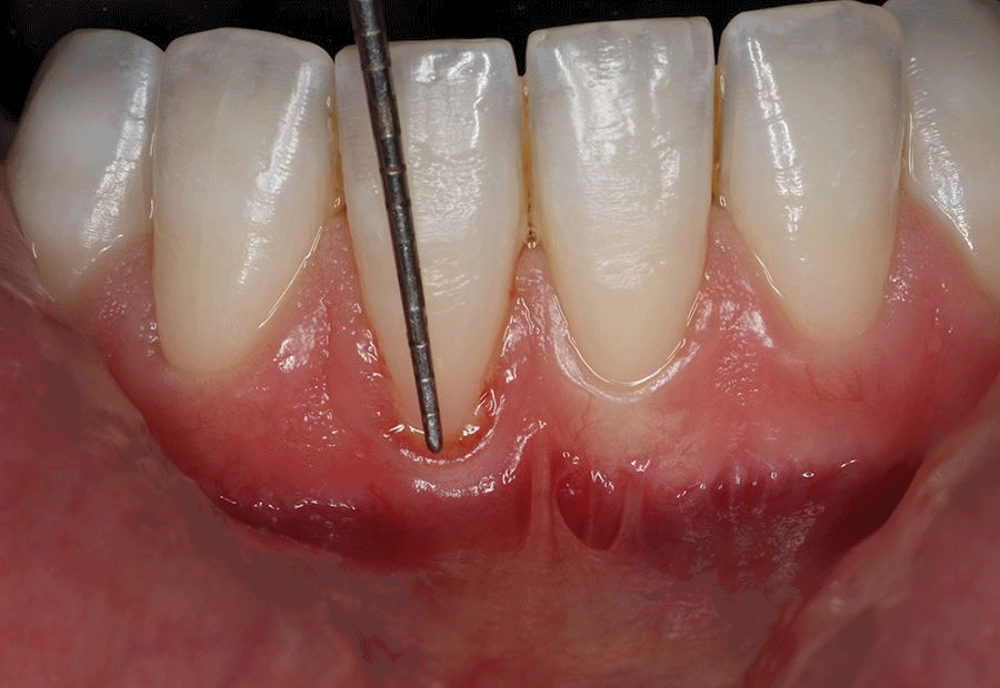 Periodoncia – PDSTUDIO